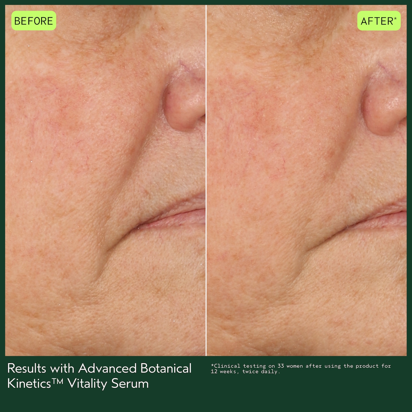 Vitality Serum | Aveda