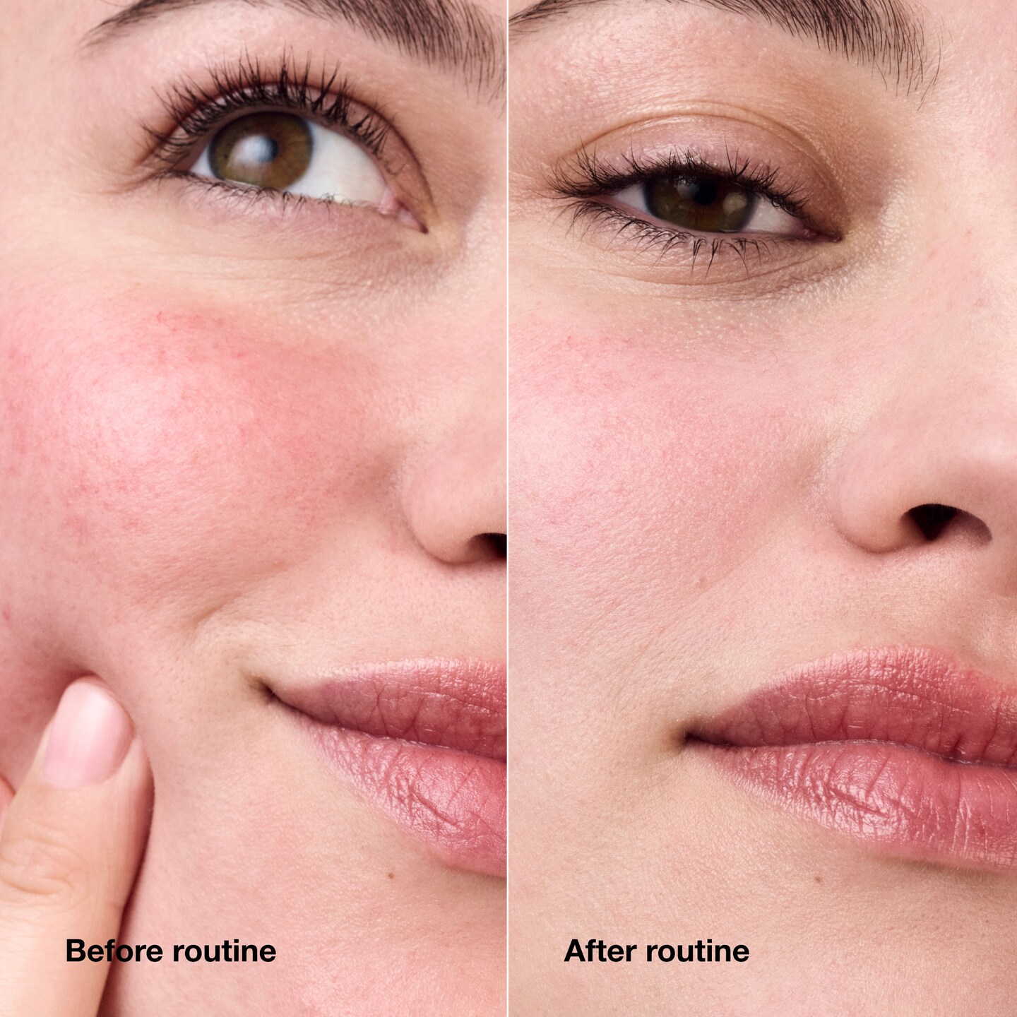 Redness Solutions Daily Relief Cream With Microbiome Technology | Clinique